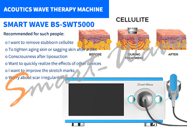 6 Transmitters Acoustic Wave Therapy Machine For Stretch Marks Removal ...