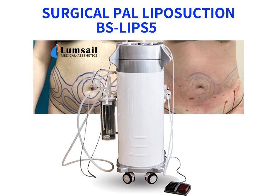 BS-LIPS5 300W Power Assisted Liposuction Equipment For Neck Breast And Chin